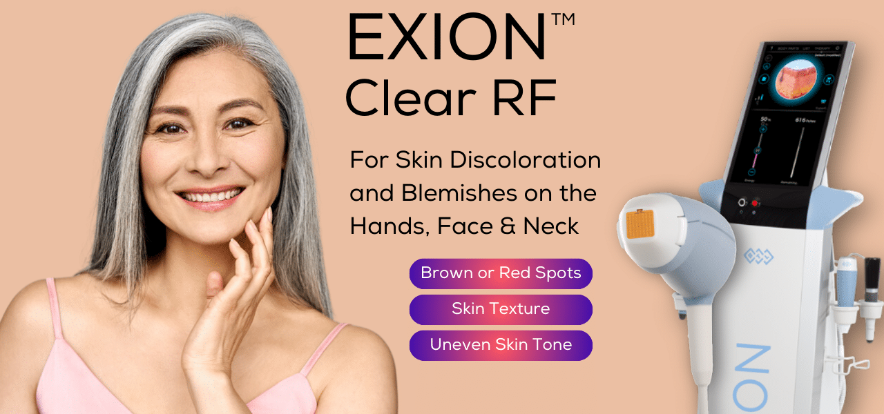 EXION CLEAR RF – Rejuve Anti Aging Medical Spa in Rancho Santa Margarita